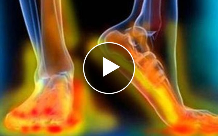 healthbay | How To Handle Neuropathy